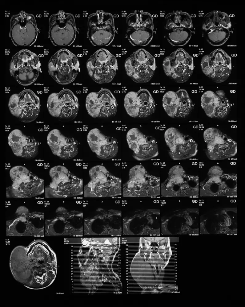 AI izafasha kugabanya ingaruka mbi za MRI