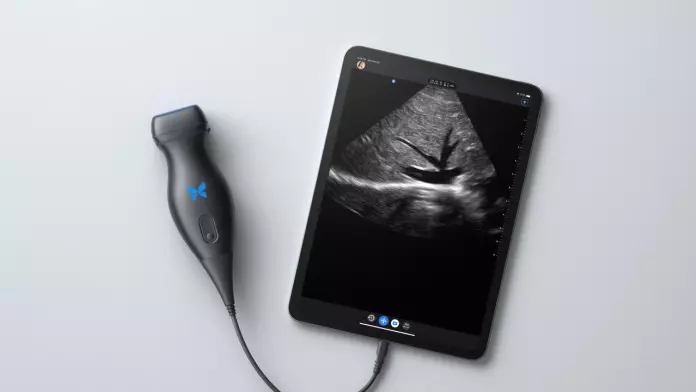 IPhone kaj ultrasono helpos diagnozi koronaviruson malproksime