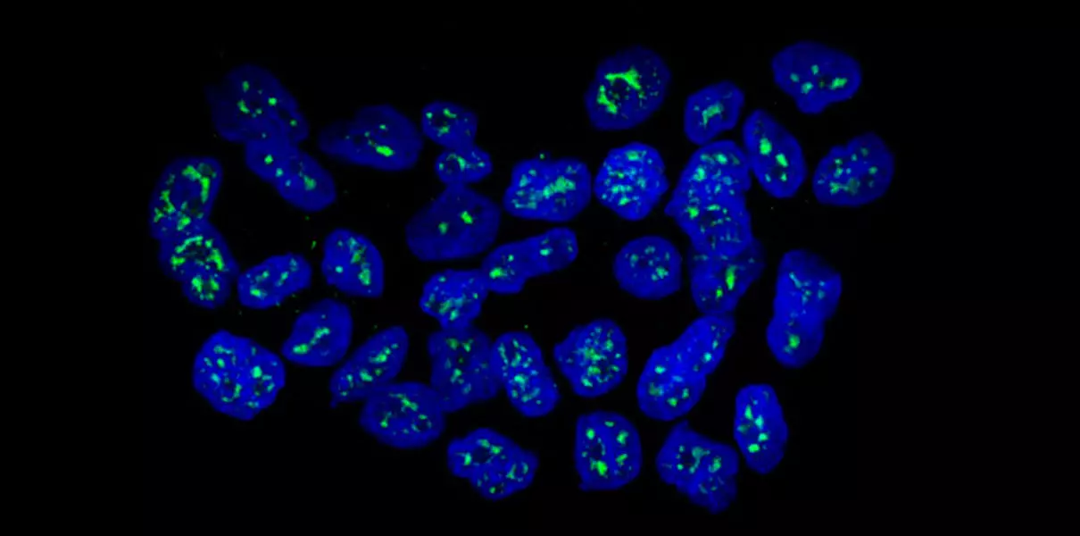 En start från Skolkovo har skapat ett system för att påskynda diagnosen cancer 108119_1