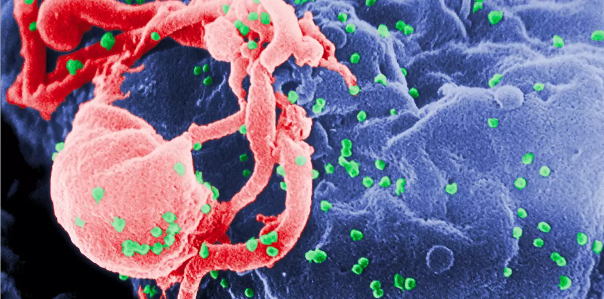 Nová vakcína proti HIV chráni pred viacerými kmeňmi naraz