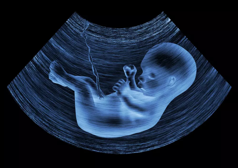Kuzaliwa na ultrasound: ujauzito wa 4D, utaftaji mbaya na upasuaji wa ujauzito