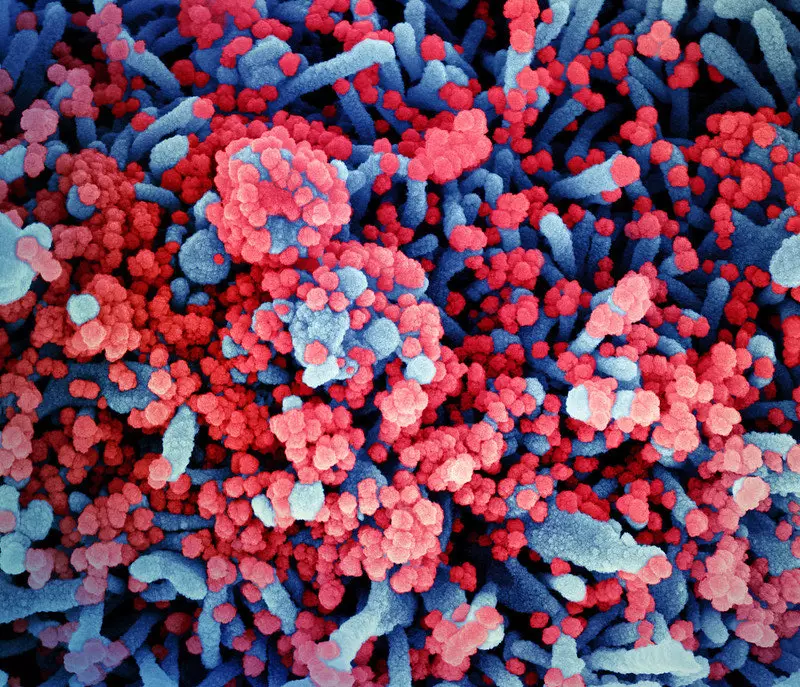 Mutoitunut koronavirus voi oppia pääsemään soluihin uudella tavalla