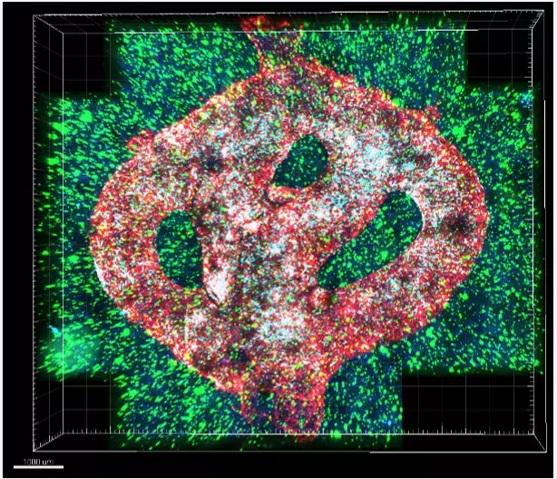 科學家們首次對整個癌症進行了 3D 生物打印 42046_1