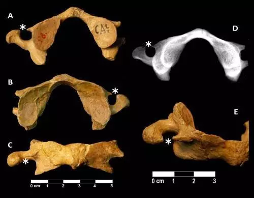 ការសិក្សា៖ Neanderthals បានបាត់ខ្លួនដោយសារភាពចម្រុះហ្សែនទាប