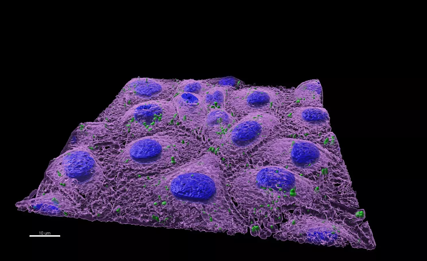 Como os nanoplásticos alteran o microbioma intestinal e ameazan a saúde