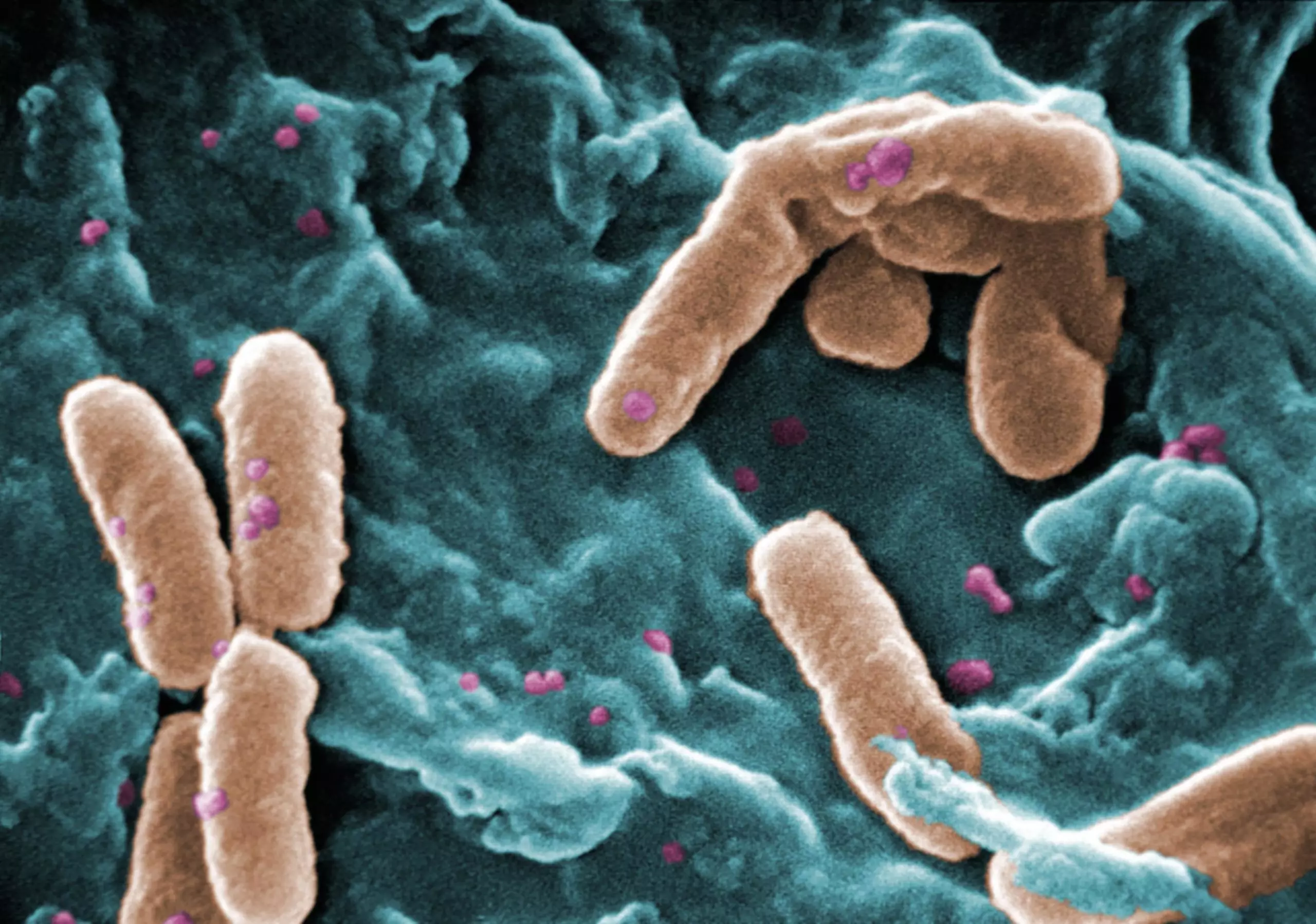 Pseudomonas aeruginosa жаңа штаммы микропластикалық бөлшектерді жояды