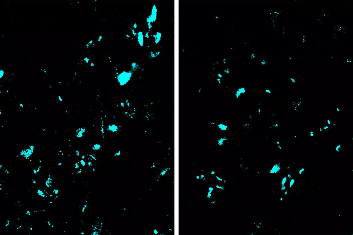 Zinātnieki pārtrauc sklerozi pelēm ar CRISPR