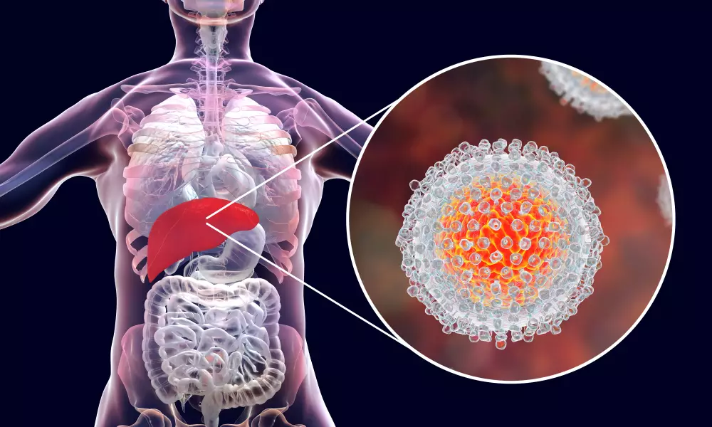 Az orvosi Nobel -díjat a hepatitis C vírussal kapcsolatos kutatásokért ítélték oda