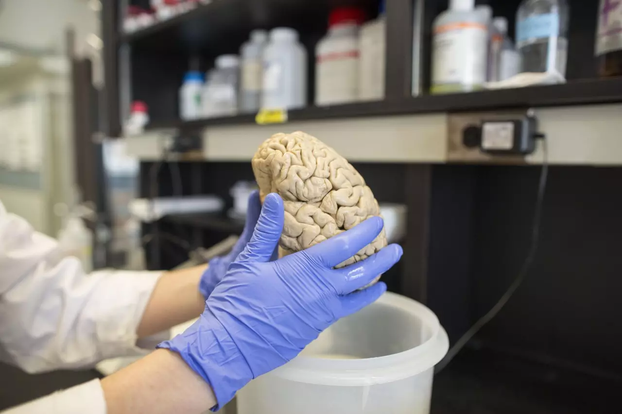 Mokslininkai galės nustatyti Alzheimerio ligą ankstyvoje stadijoje 47090_1