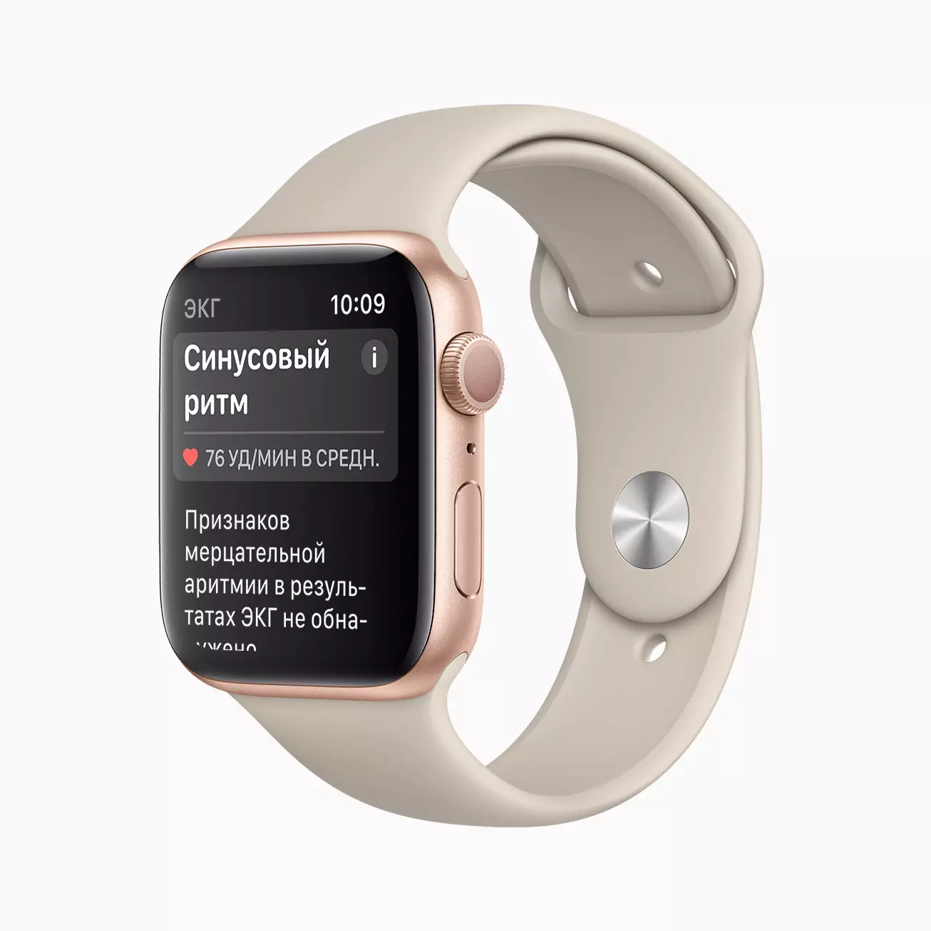 Bydd swyddogaeth ECG yn ymddangos ar Apple Watch Rwseg 47937_1