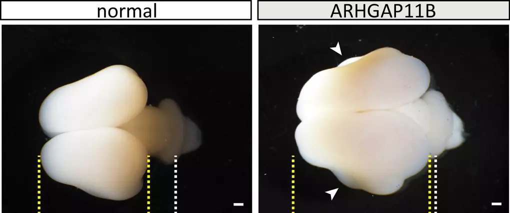 Los científicos criaron un embrión de mono con una corteza cerebral humana 50786_1