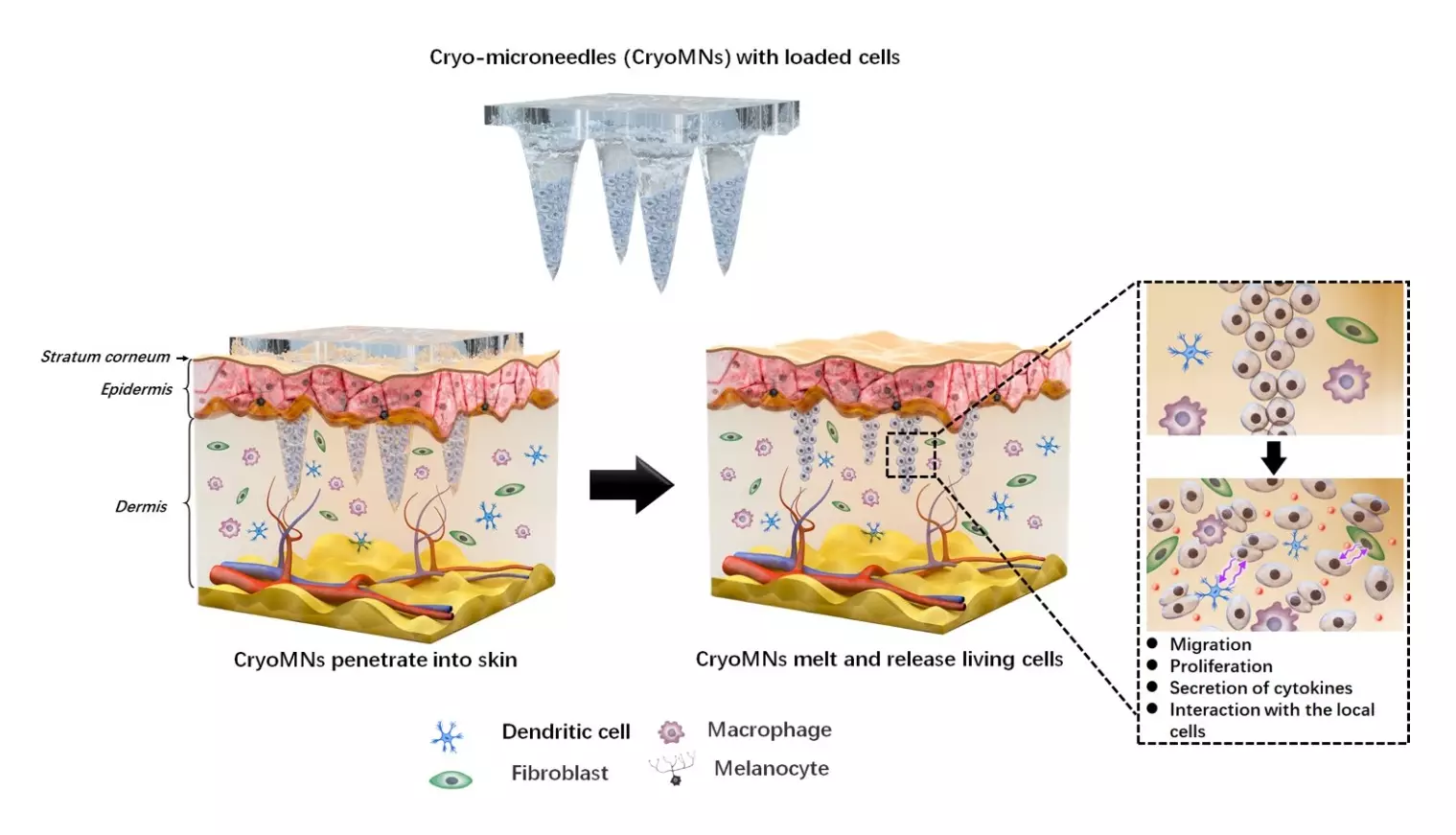 Microneedle мөсөн хэсэг нь эмийг хүргэж, дараа нь хайлуулдаг 51220_1