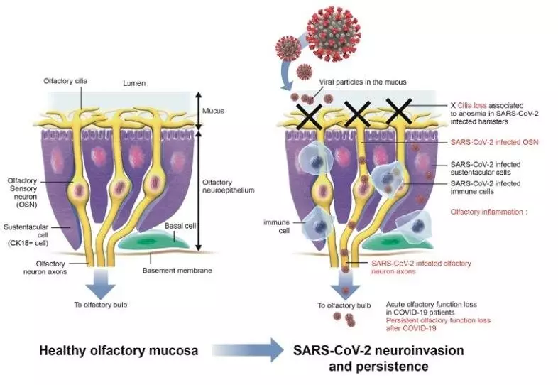 Mekanisme kehilangan bau ketika dijangkiti dengan coronavirus ditemui 51661_1