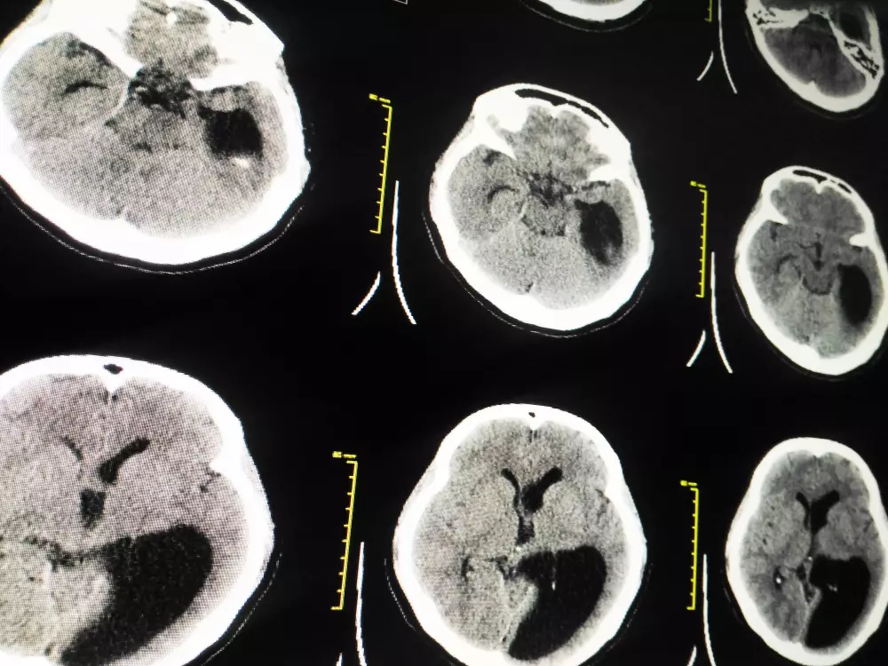 Neuroscientists MIT yo te jwenn karakteristik nan newòn yo nan sèvo imen an. Sa ka eksplike Aparisyon entèlijans. 52544_1