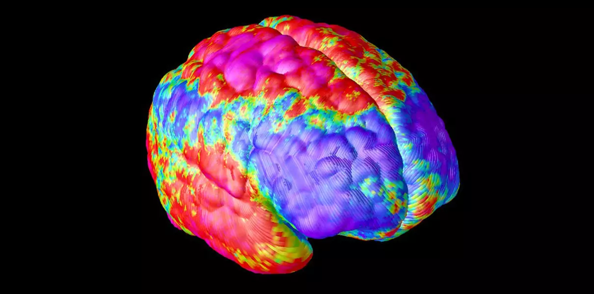 Inteligence závisí na spojeních v mozku 54229_2