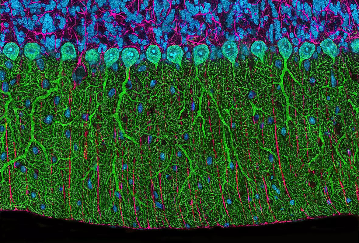 Il ruolo dei geni nello sviluppo dell'intelligenza è esagerato 60094_2