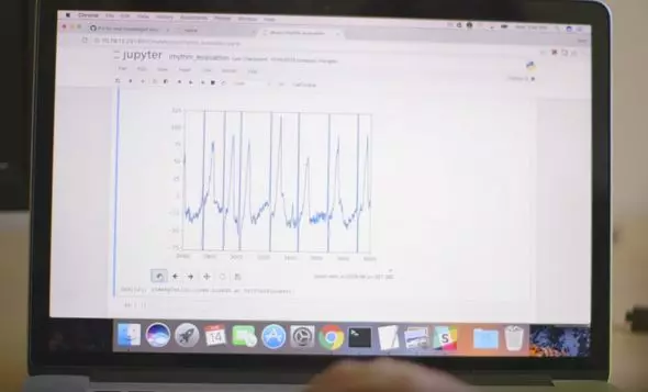 I-algorithm ka-Andrew Ng ingcono ekufumaneni i-arrhythmias kunoogqirha 65027_2