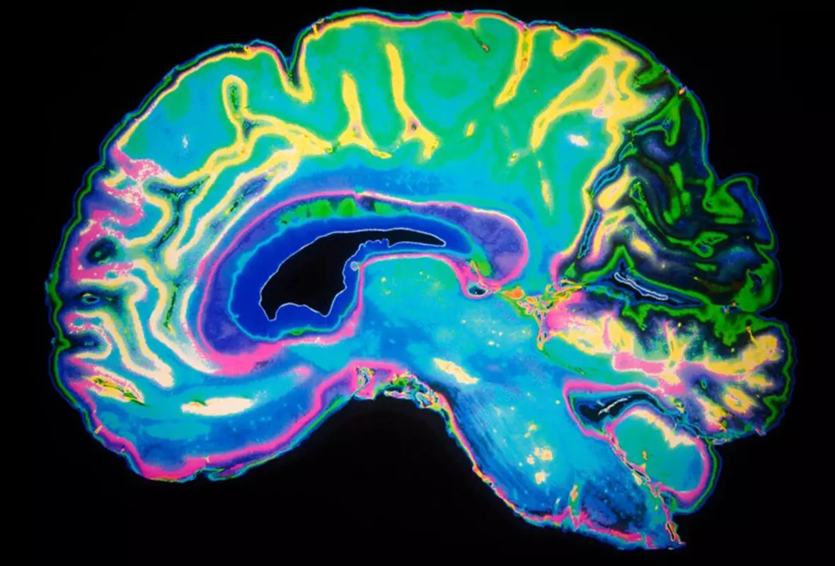 Percetakan 3D sareng katirisan cryogenik bakal ngabantosan numuwuhkeun organ 71937_1